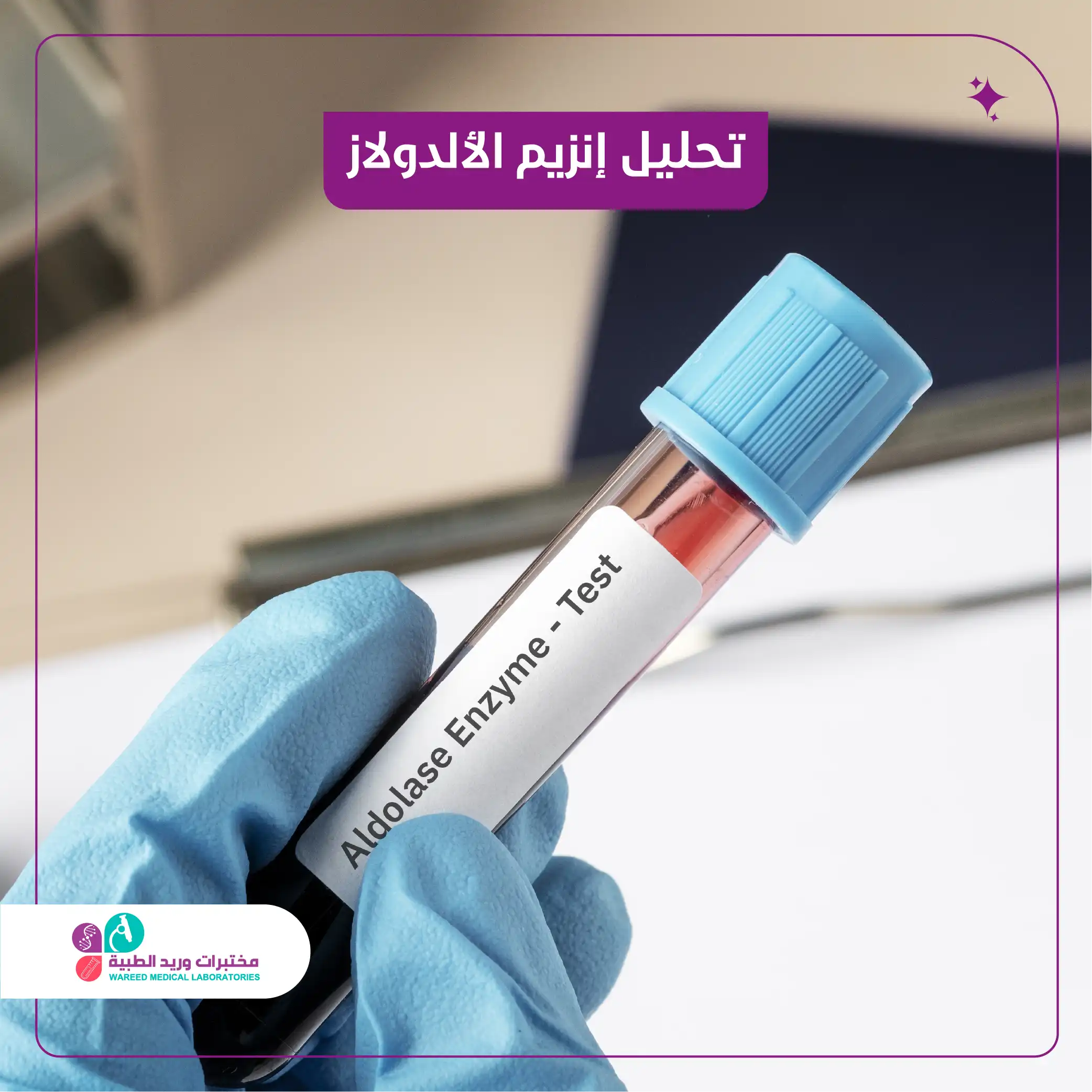 إنزيم الألدولاز (Aldolase Test) | دلالاته وأسباب ارتفاعه
